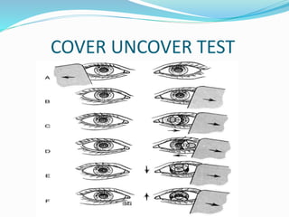 Heterophoria investigation and management | PPTX