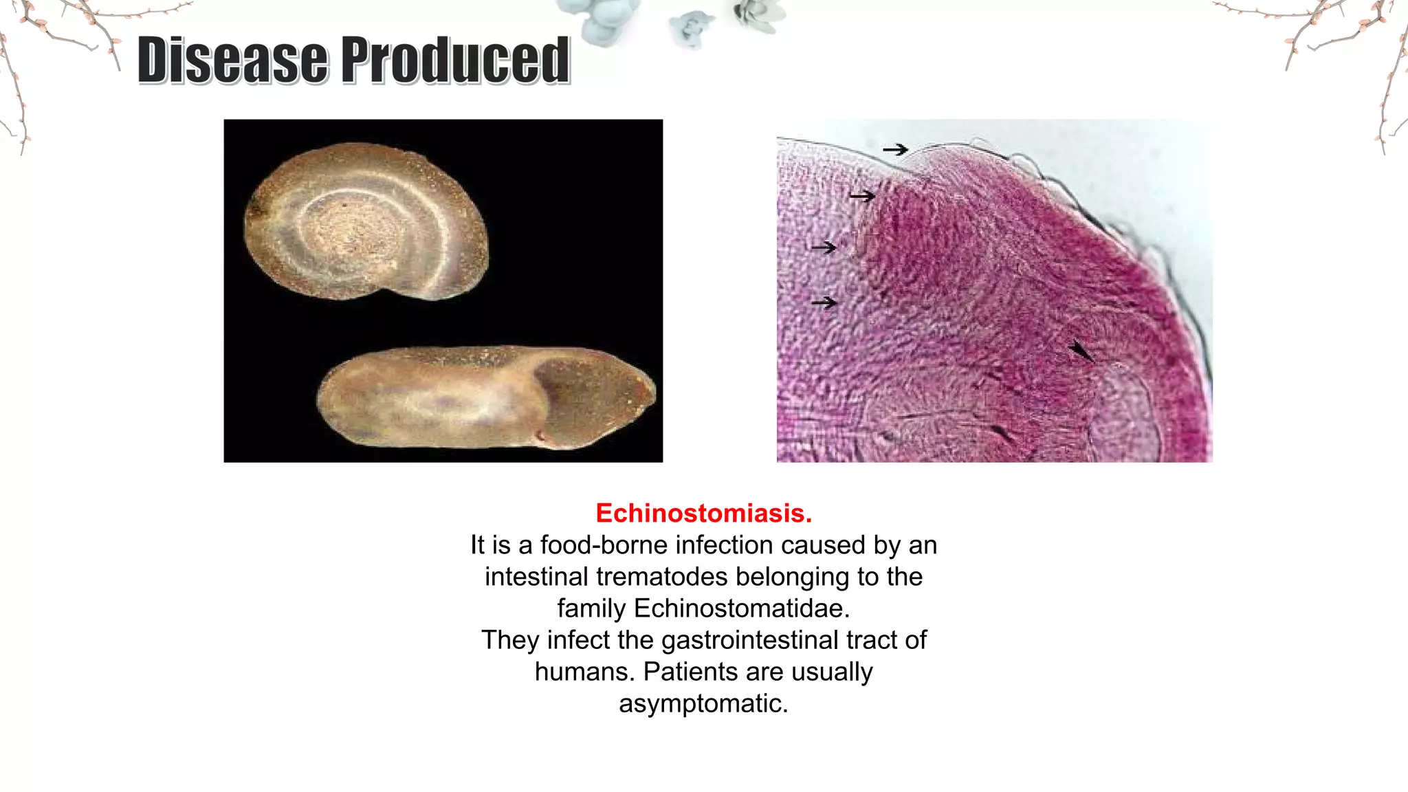 Heterophyes-Heterophyes-Echinostoma-Species-Casmer-Jubelag.pdf