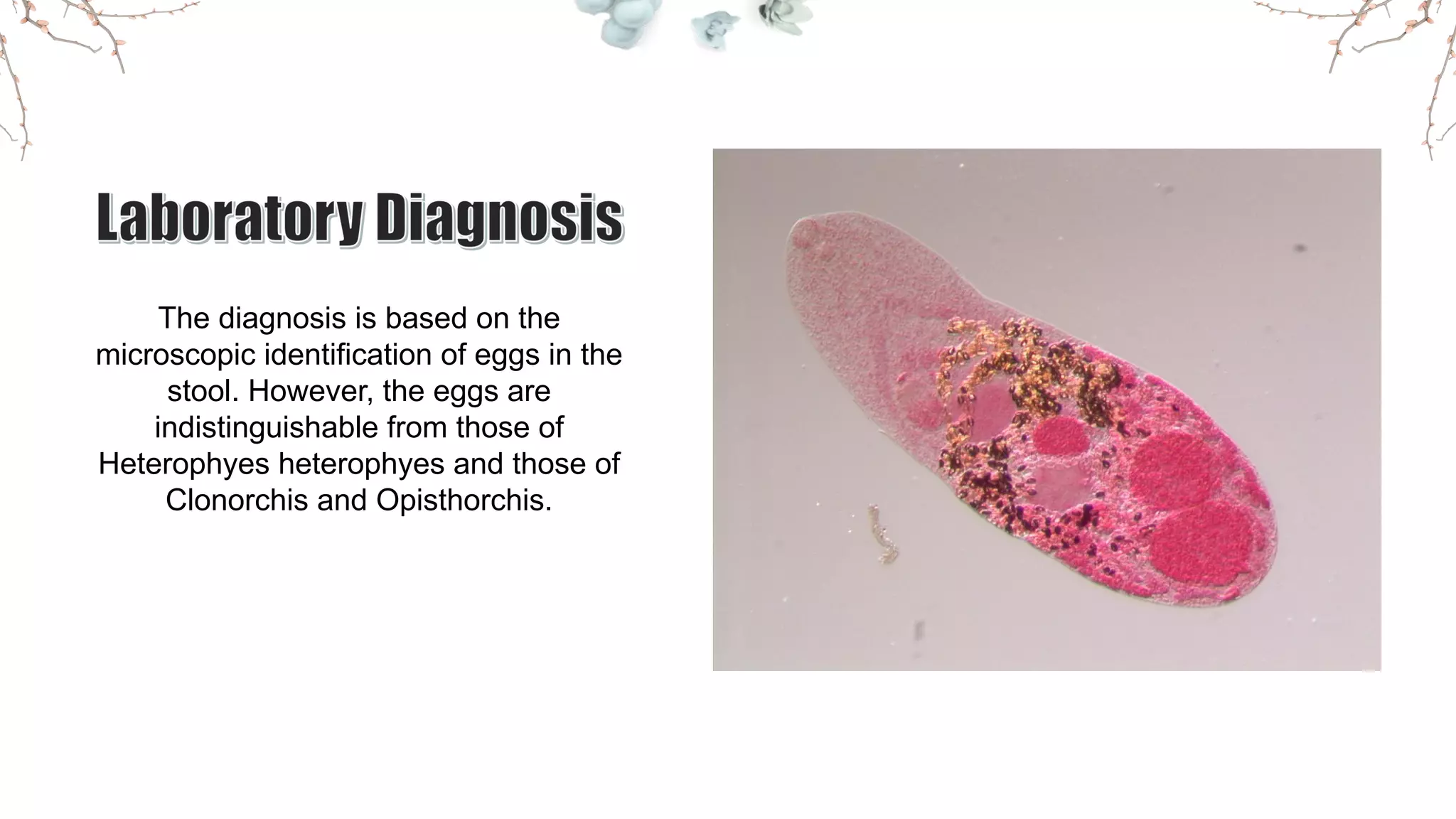 Heterophyes-Heterophyes-Echinostoma-Species-Casmer-Jubelag.pdf