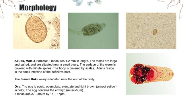 Heterophyes-Heterophyes-Echinostoma-Species-Casmer-Jubelag.pdf