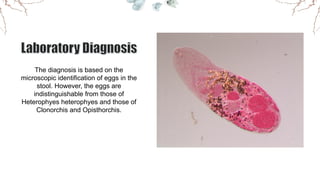 Heterophyes-Heterophyes-Echinostoma-Species-Casmer-Jubelag.pdf