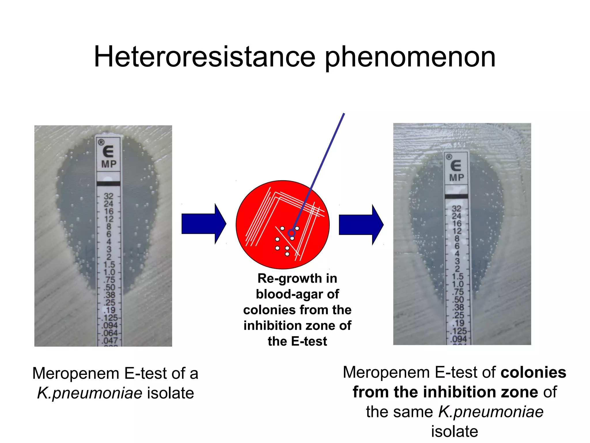 Can Meropenem Heteroresistance in OXA-48-Producing K. pneumoniae be ...