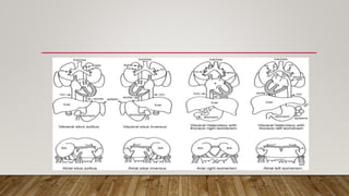Heterotaxy syndrome.pptx