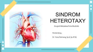 heterotaxy syndrome.pptx