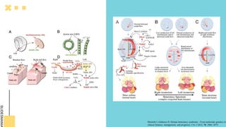 heterotaxy syndrome.pptx