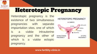 Symptoms And Treatment For Heterotopic Pregnancy | PDF