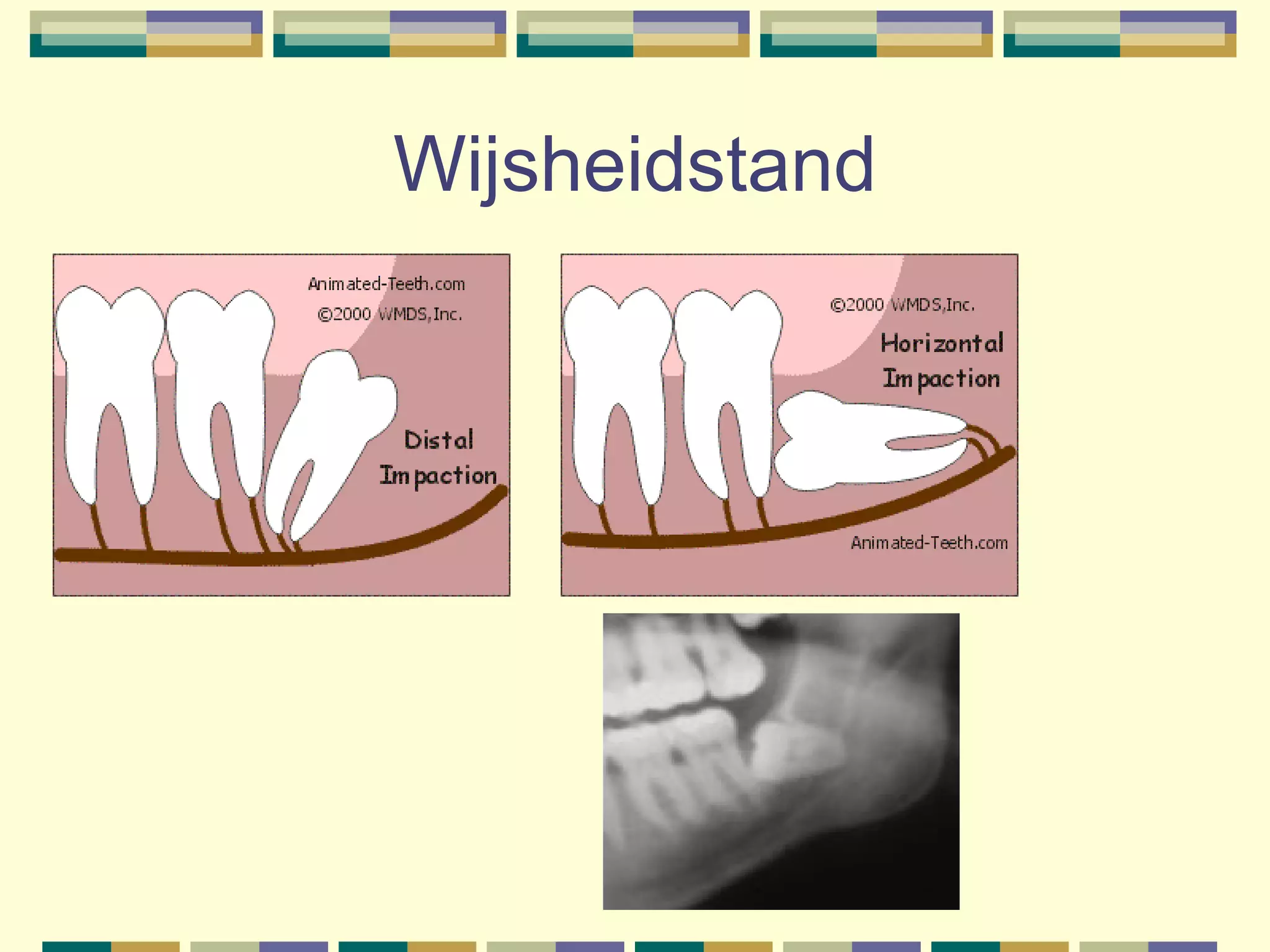 Het Gebit | PPT | Oral care | Personal Care