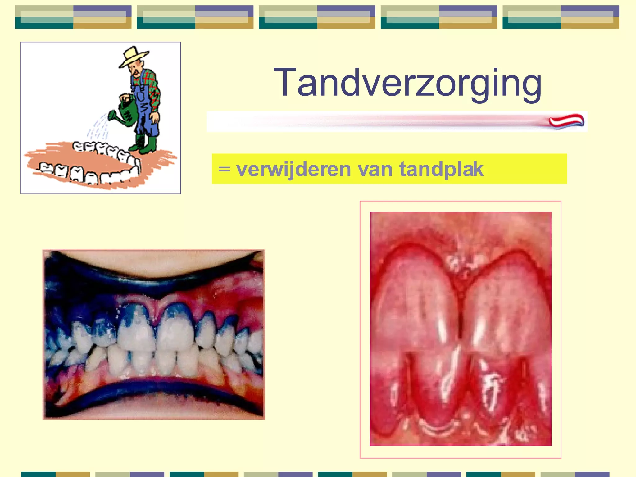 Het Gebit | PPT | Oral care | Personal Care