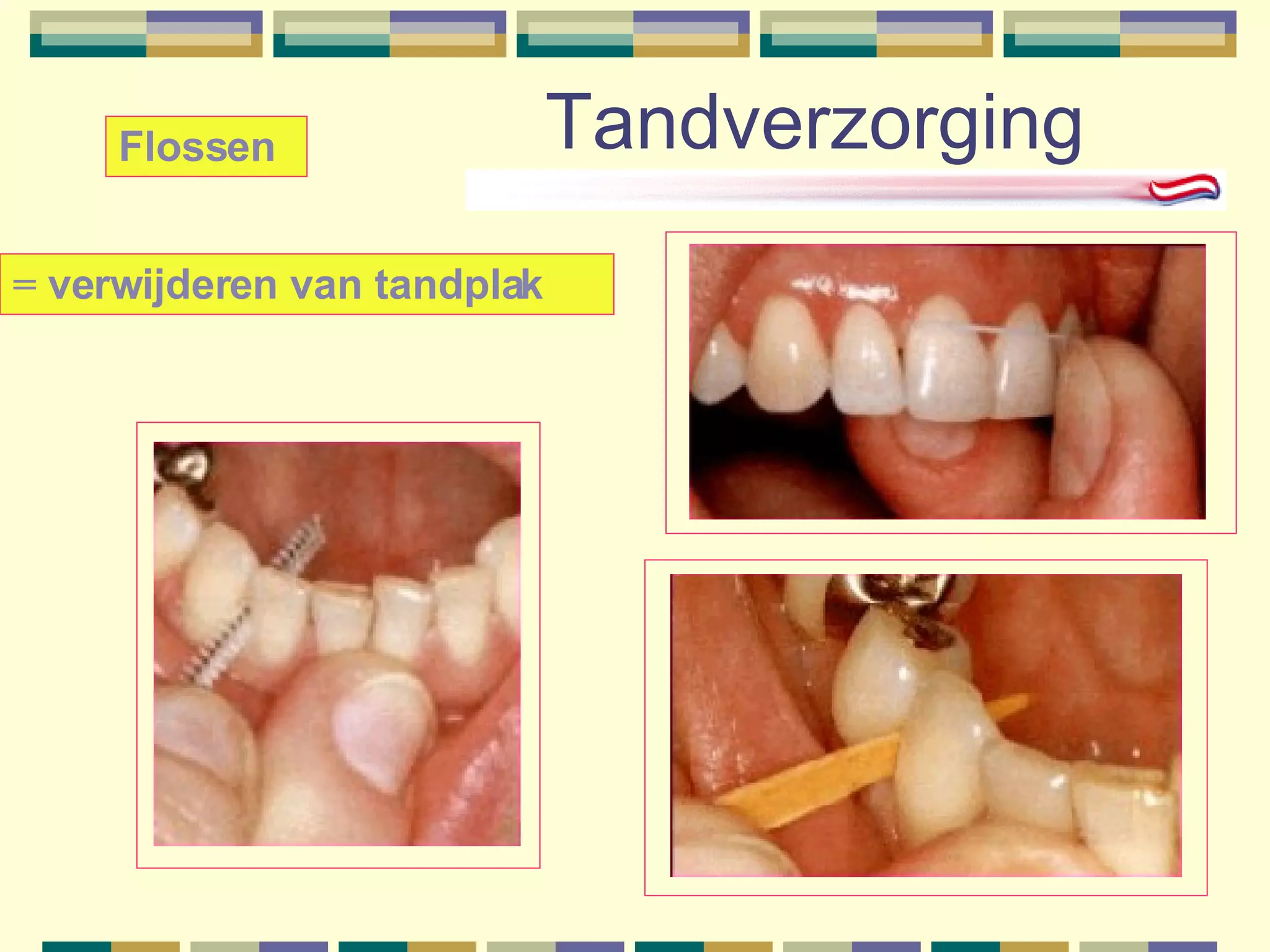 Het Gebit | PPT | Oral care | Personal Care