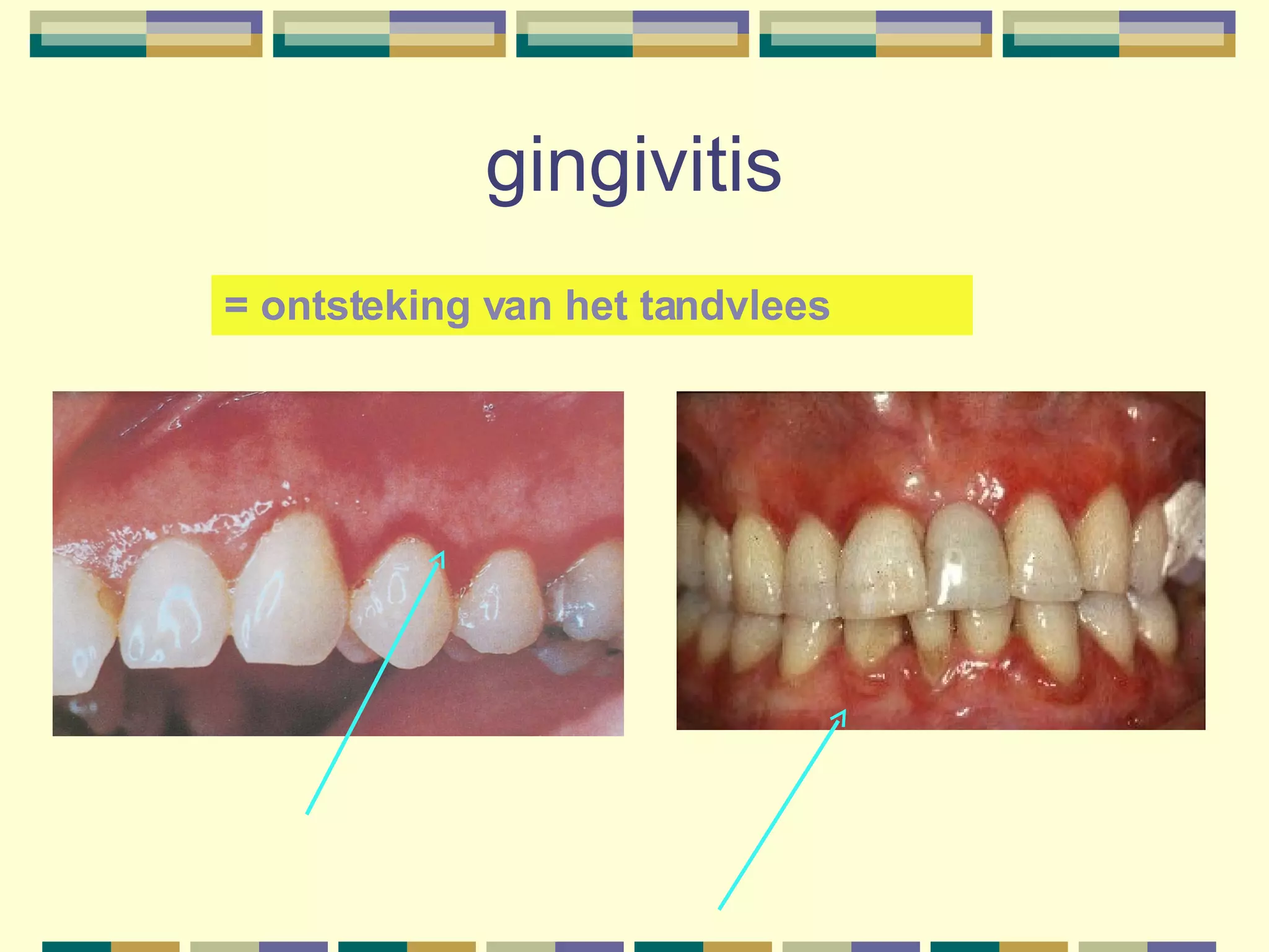 Het Gebit | PPT | Oral care | Personal Care