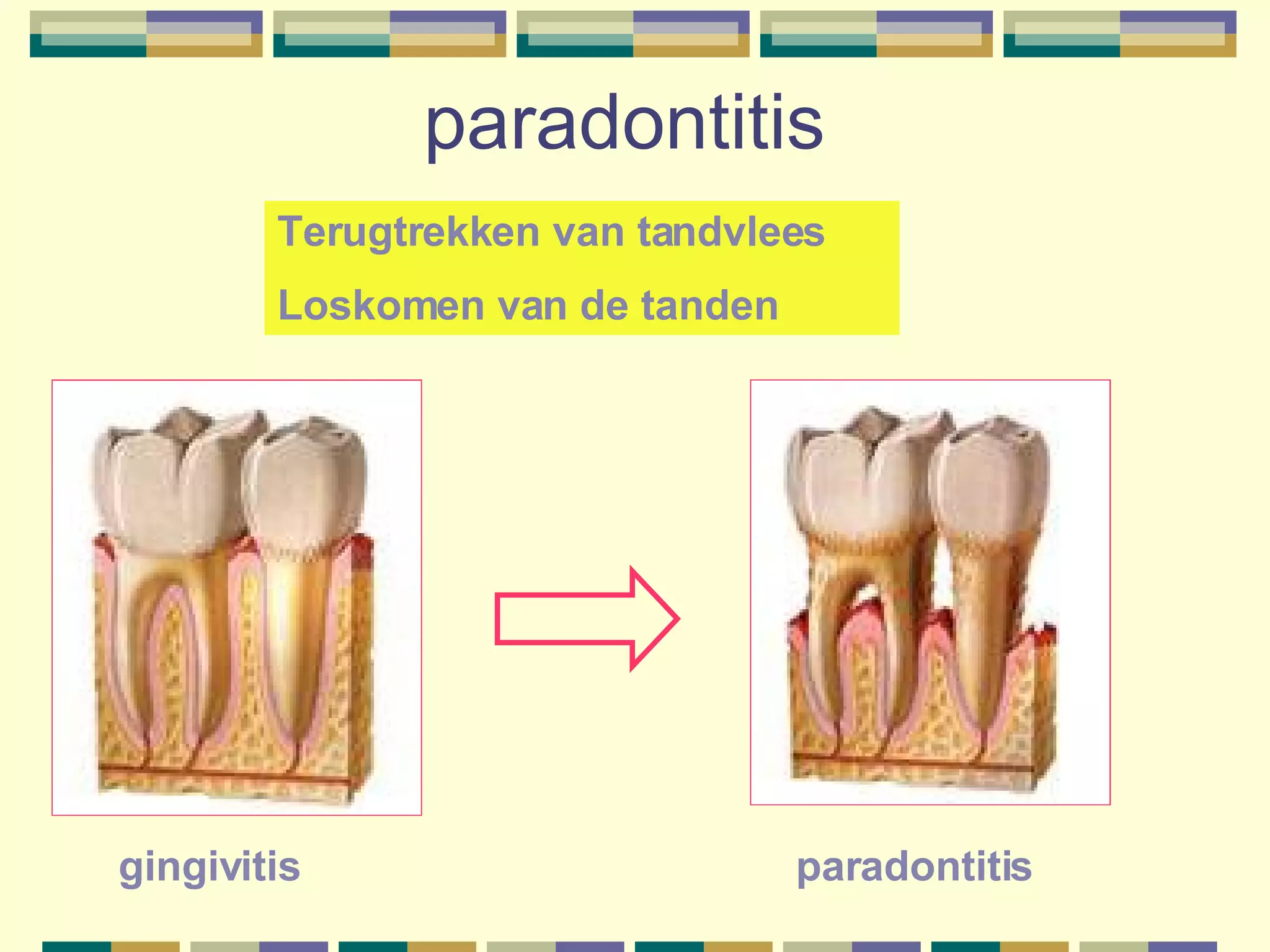 Het Gebit | PPT | Oral care | Personal Care