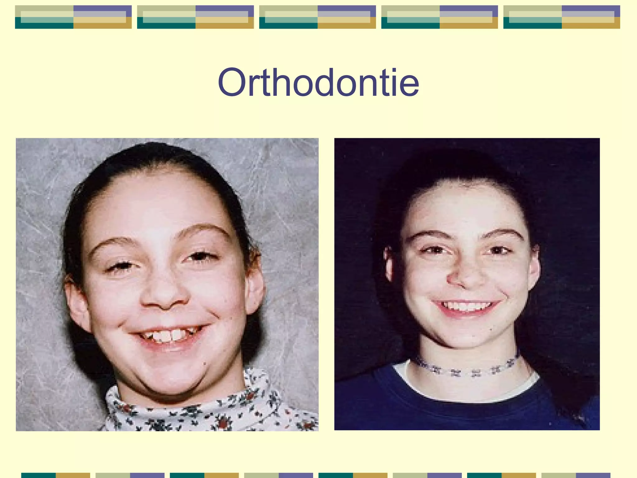 Het Gebit | PPT | Oral care | Personal Care