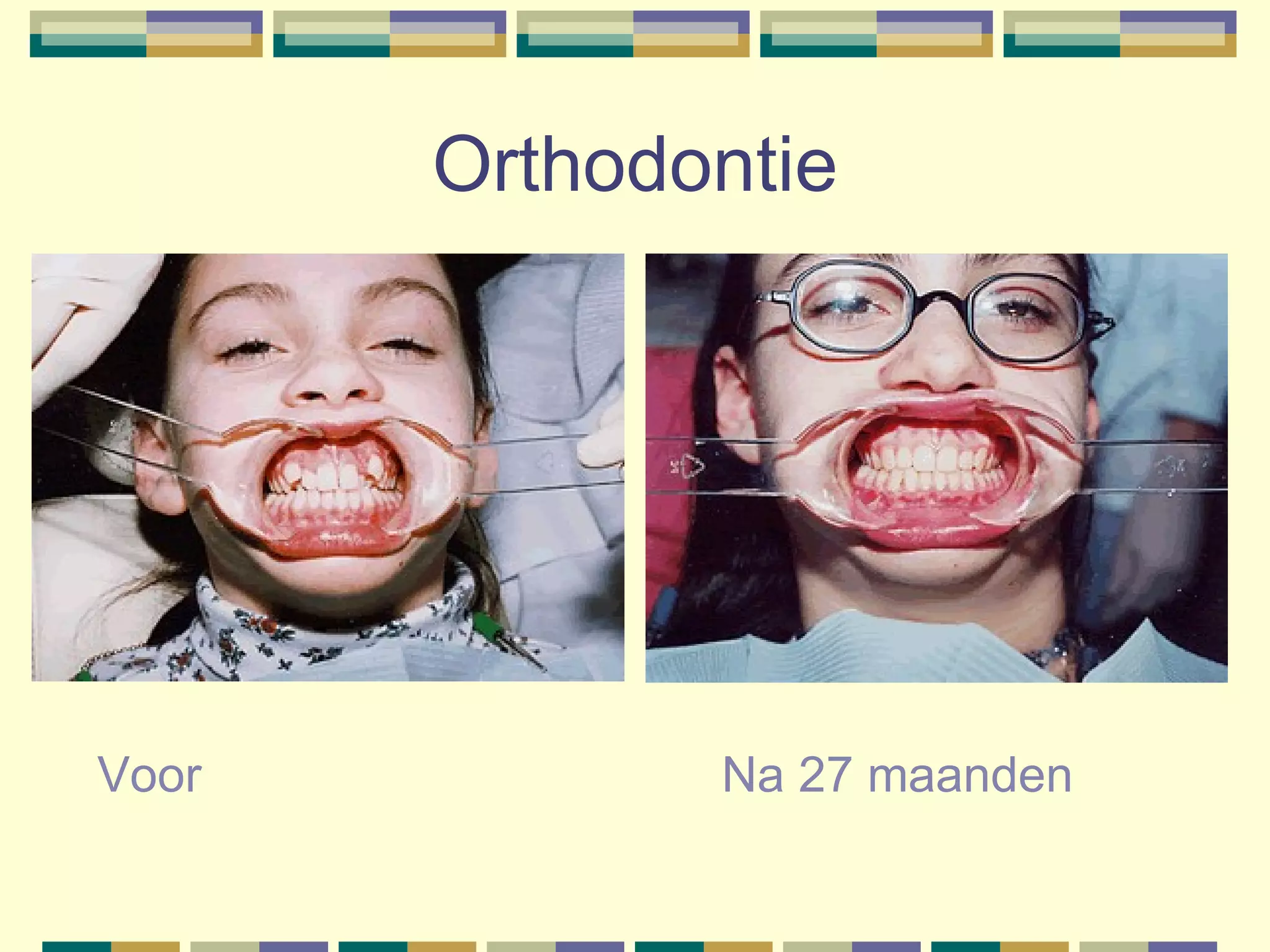 Het Gebit | PPT | Oral care | Personal Care