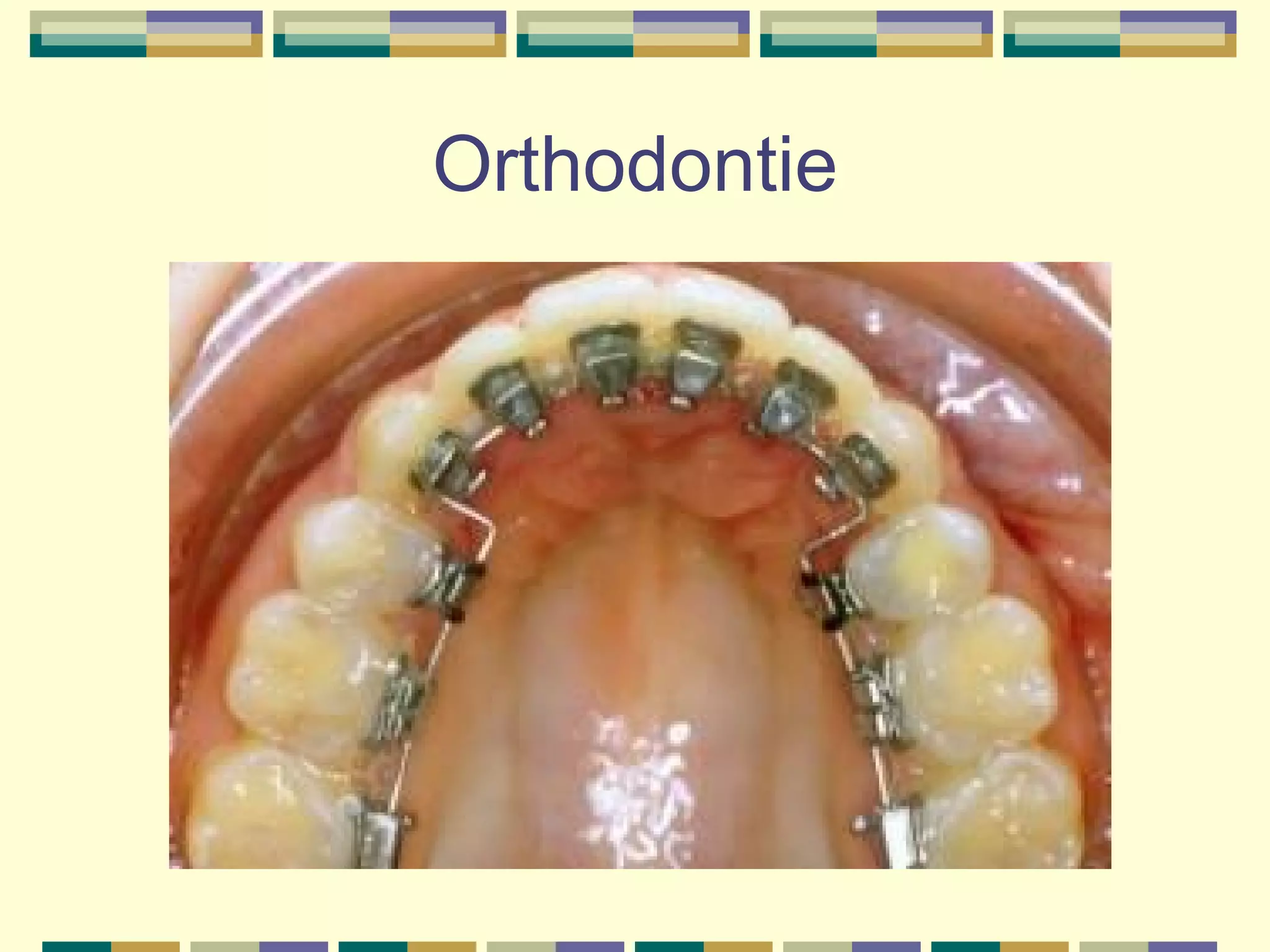 Het Gebit | PPT | Oral care | Personal Care