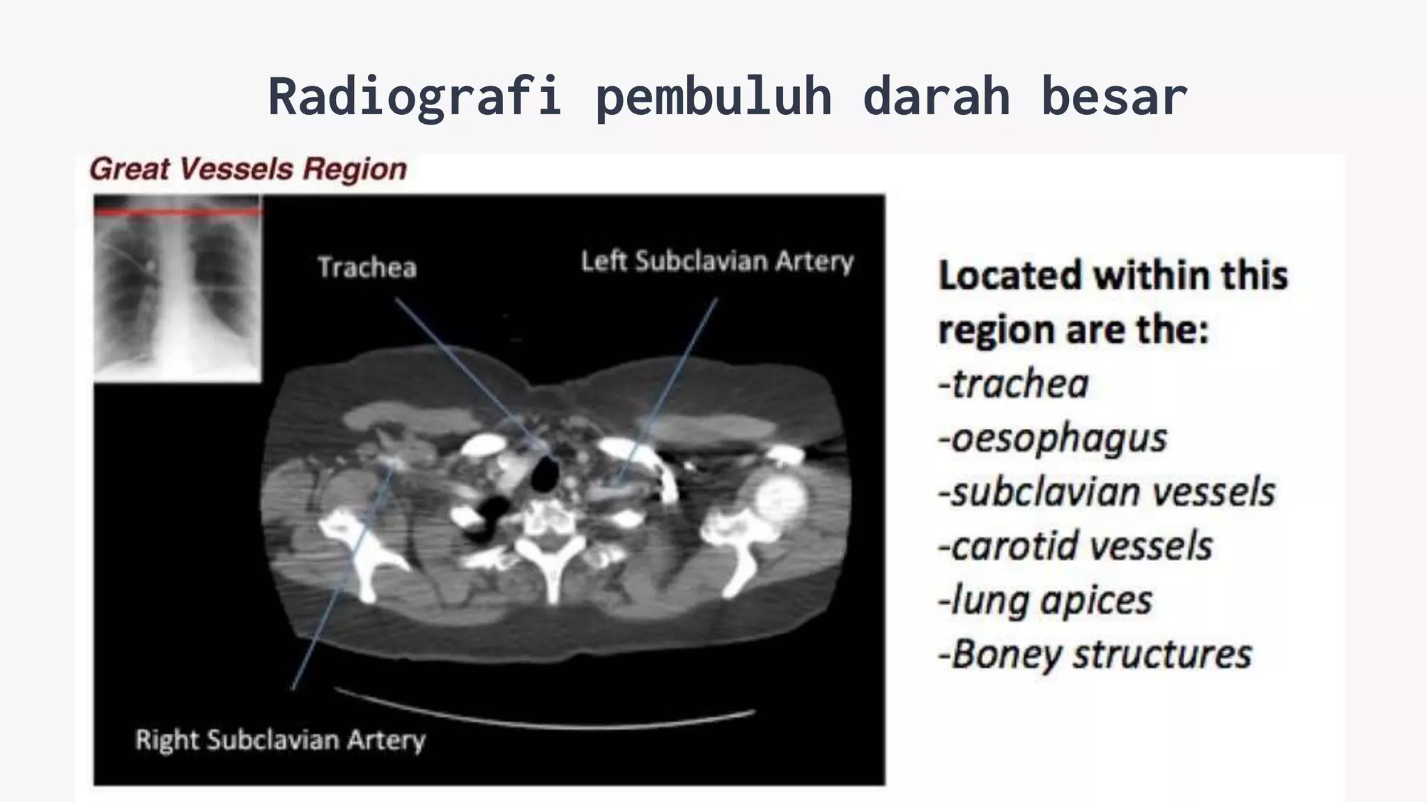 Dasar CT Scan Toraks.pptx