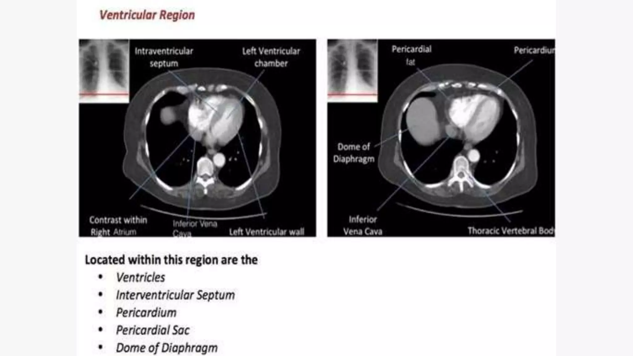 Dasar CT Scan Toraks.pptx
