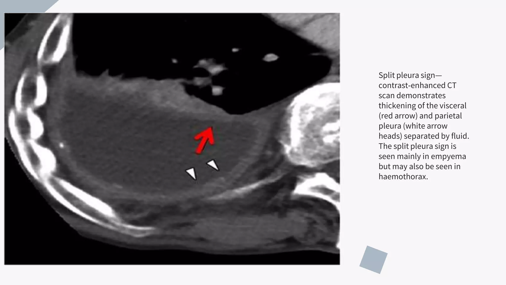 Dasar CT Scan Toraks.pptx