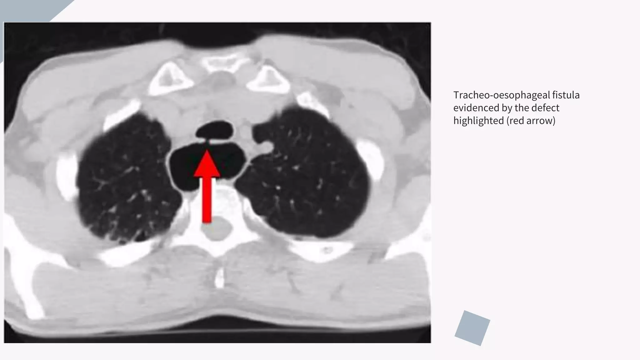 Dasar CT Scan Toraks.pptx
