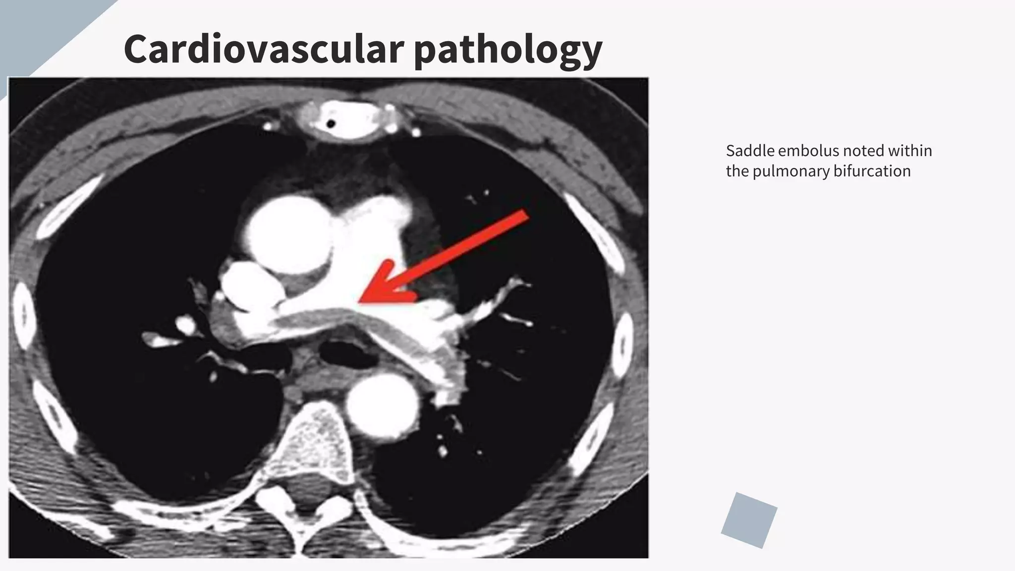 Dasar CT Scan Toraks.pptx