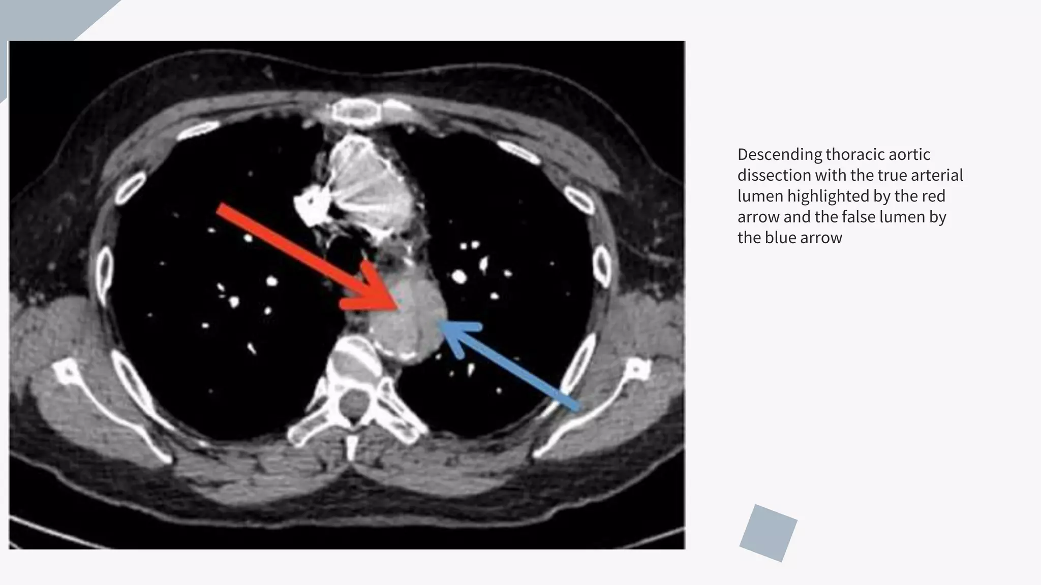 Dasar CT Scan Toraks.pptx