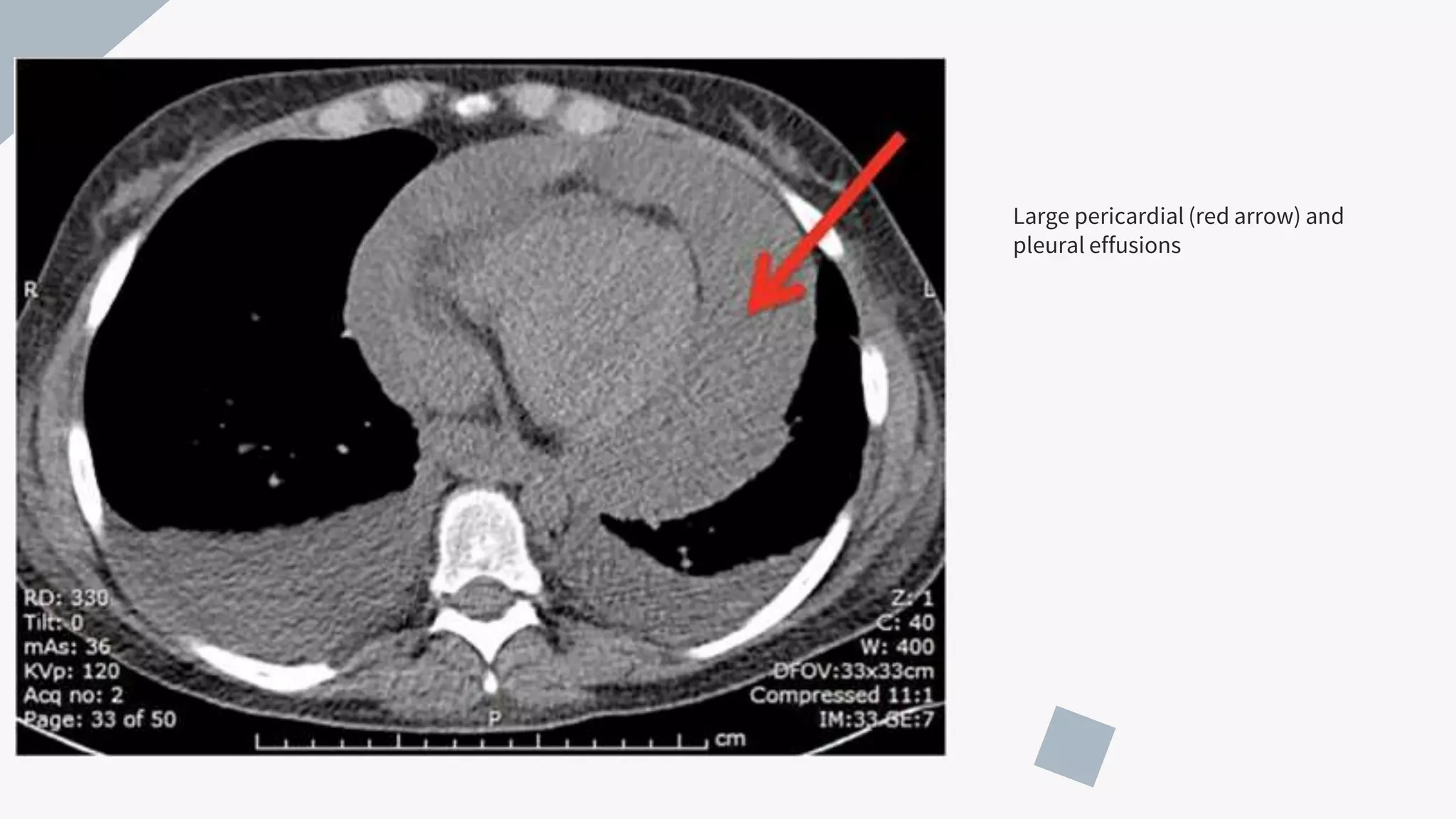 Dasar CT Scan Toraks.pptx