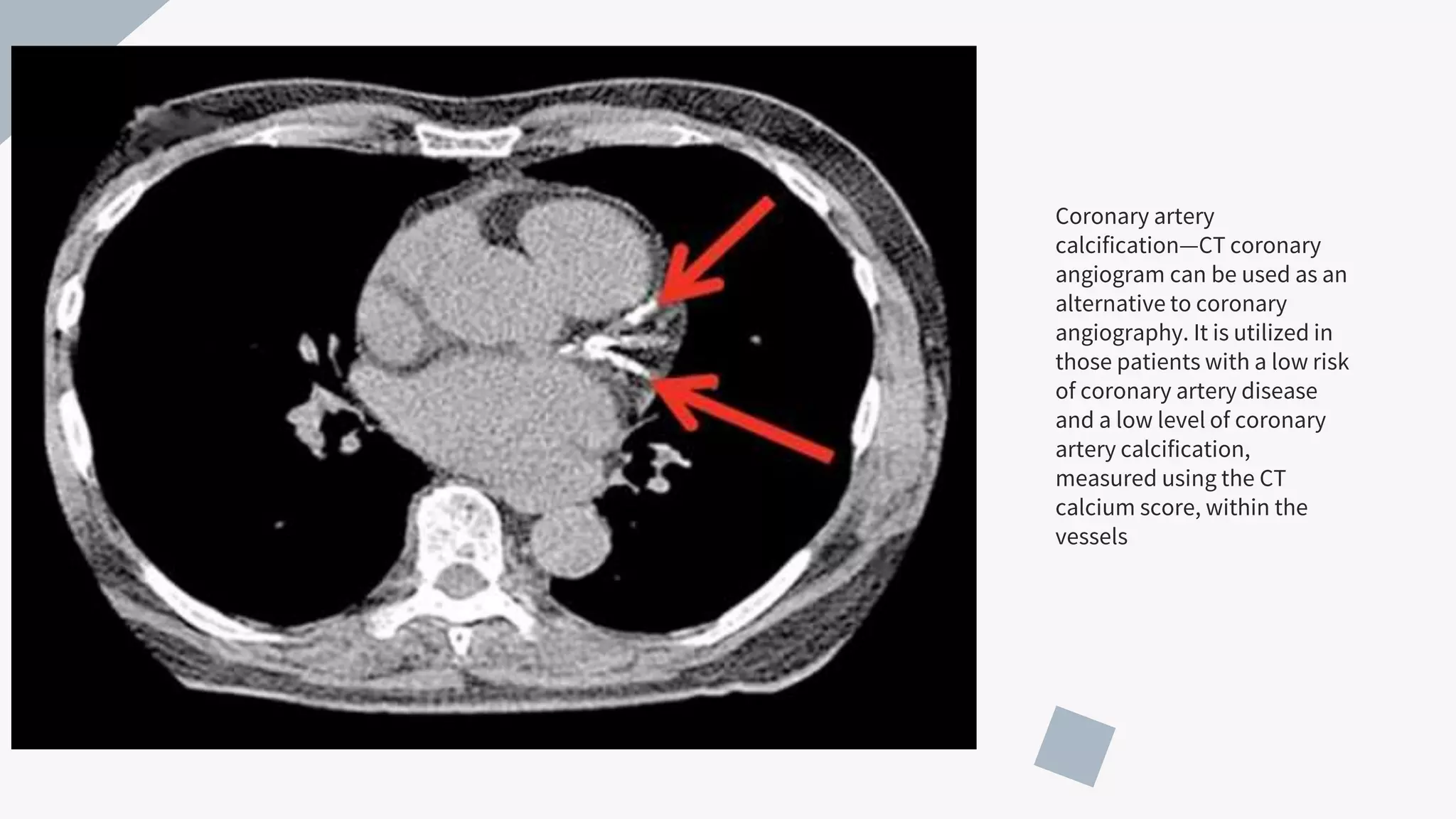 Dasar CT Scan Toraks.pptx
