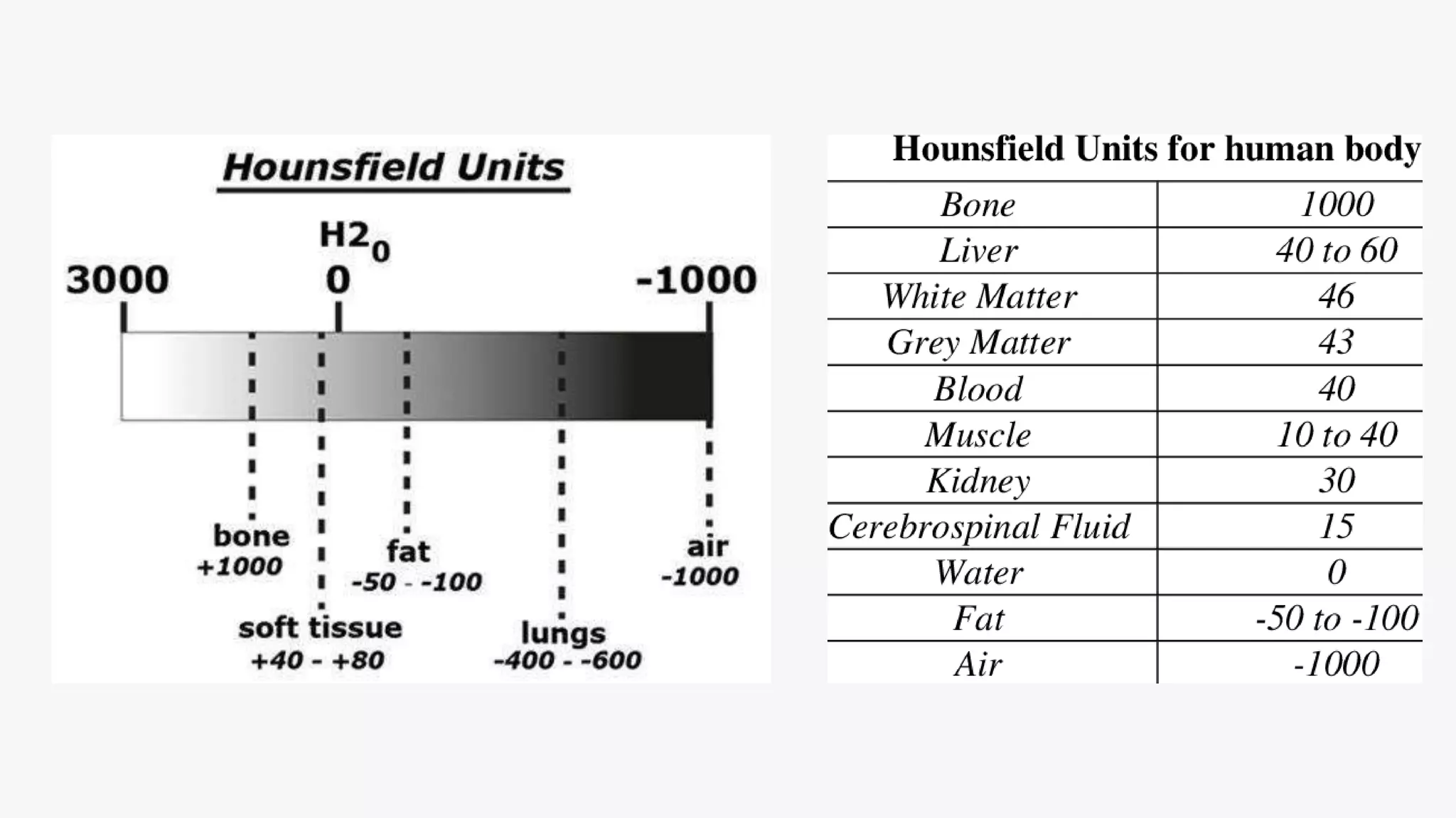 Dasar CT Scan Toraks.pptx