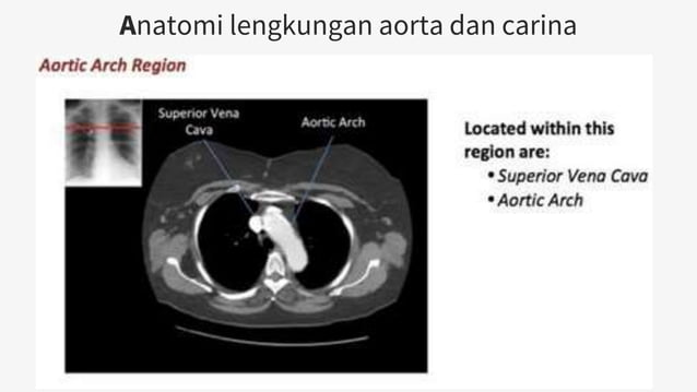 Dasar CT Scan Toraks.pptx