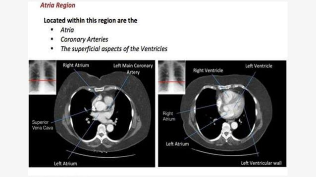 Dasar CT Scan Toraks.pptx