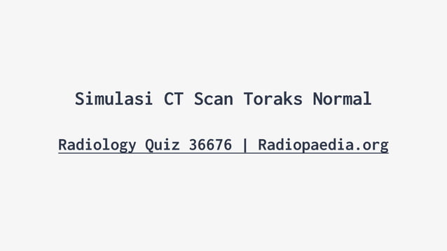 Dasar CT Scan Toraks.pptx