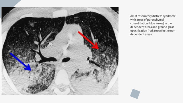 Dasar CT Scan Toraks.pptx