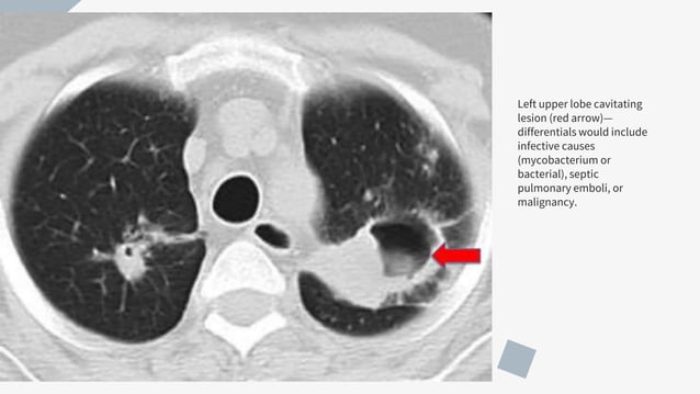Dasar CT Scan Toraks.pptx