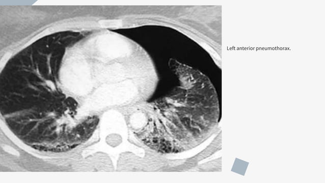 Dasar CT Scan Toraks.pptx