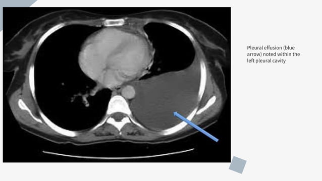 Dasar CT Scan Toraks.pptx