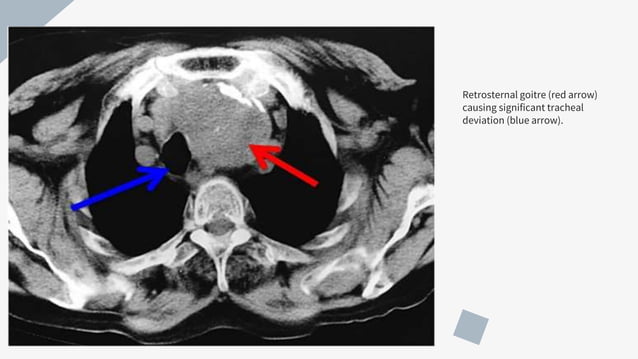 Dasar CT Scan Toraks.pptx