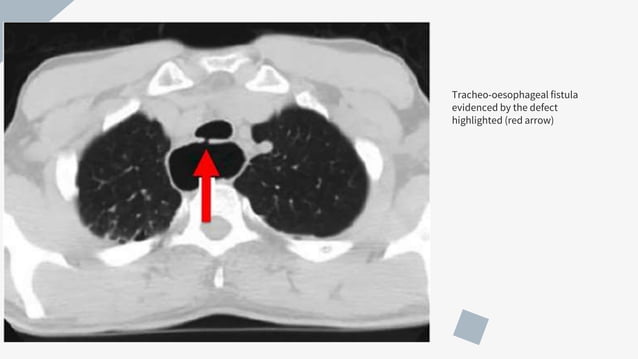 Dasar CT Scan Toraks.pptx