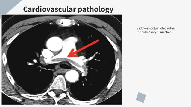 Dasar CT Scan Toraks.pptx