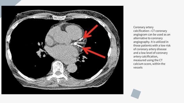 Dasar CT Scan Toraks.pptx