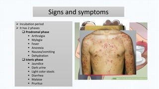 Hepatitis E Virus Presentation | PPT