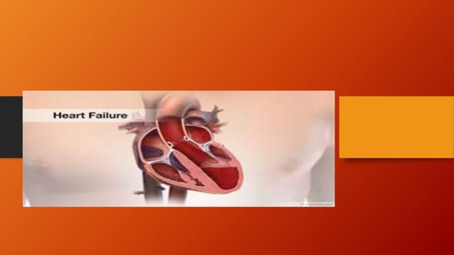 Congestive heart failure CHF | PPTX