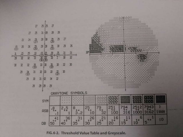 Hfa | PPTX | Eye and Vision Conditions | Diseases and Conditions