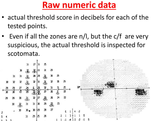 Hfa | PPTX | Eye and Vision Conditions | Diseases and Conditions