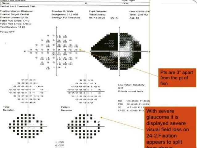 Hfa | PPTX | Eye and Vision Conditions | Diseases and Conditions