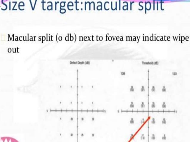 Hfa | PPTX | Eye and Vision Conditions | Diseases and Conditions