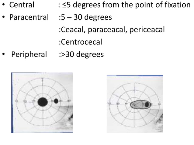 Hfa | PPTX | Eye and Vision Conditions | Diseases and Conditions