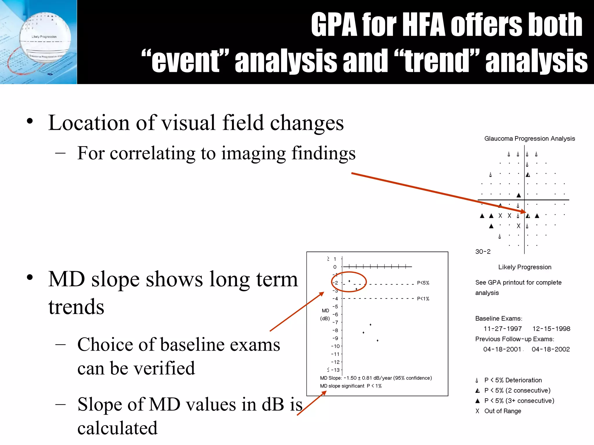 Hfa progression 110706 e | PPT | Eye and Vision Conditions | Diseases ...