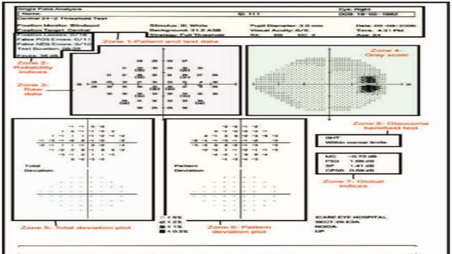 Humphreys visual field analysis powerpoint.pptx