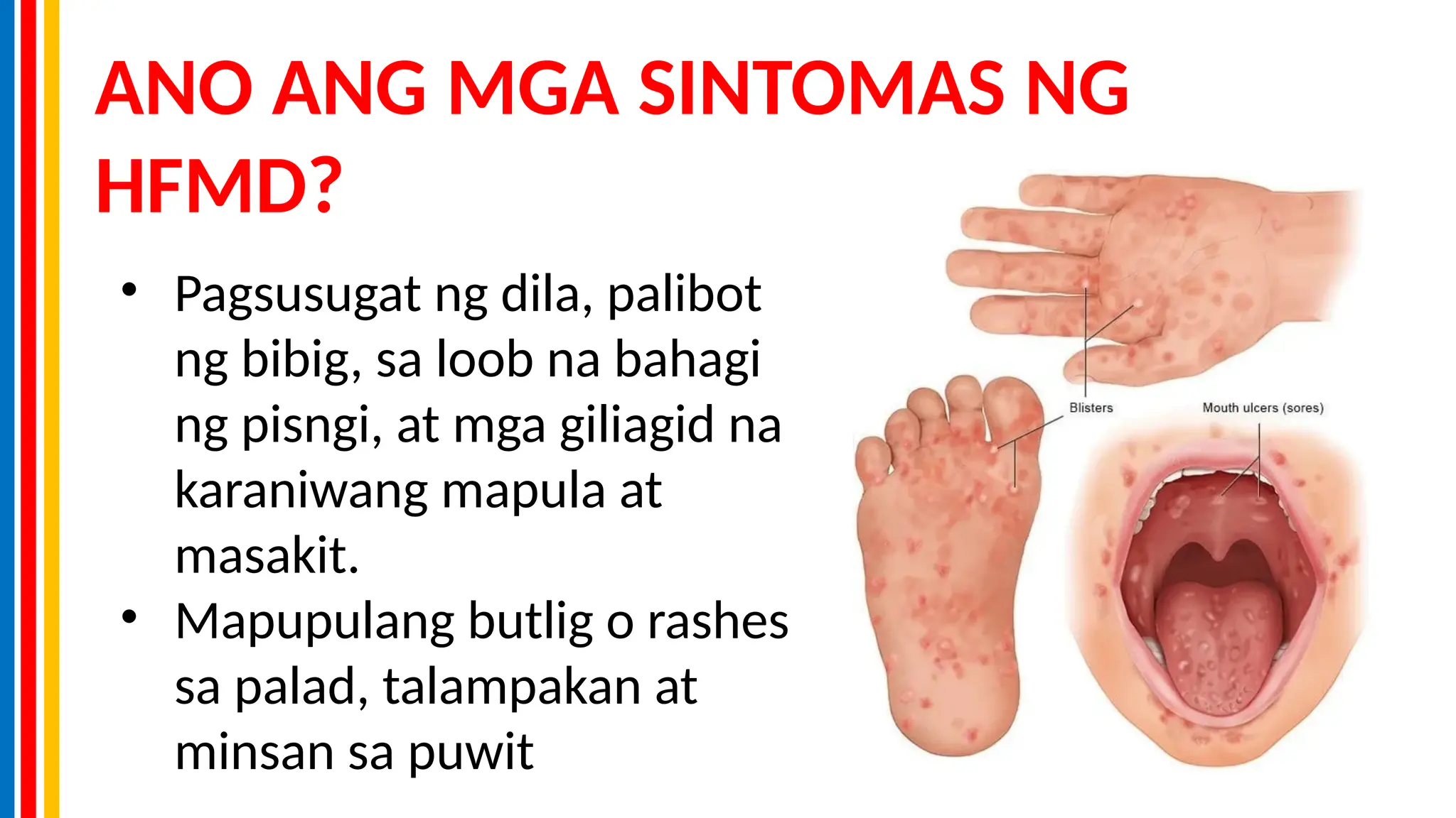 Hand and Foot Mouth Disease Health Education.pptx