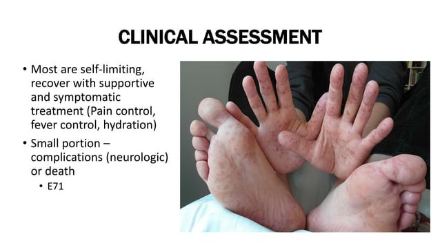 HFMD-Presentation.pptx | Infectious Diseases | Diseases and Conditions
