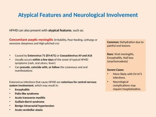 HFMD - Hand foot mouth disease, Overview | PPTX
